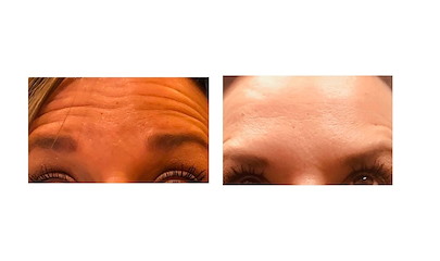 Patient Galleries | Real Smile Transformations at Dobbin Den